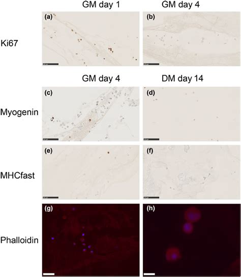 Proliferating Primary Human Myoblast Embedded In 1 Lvg Alginate Gel Download Scientific