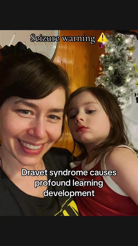 Understanding Dravet Syndrome And Seizure Management Tiktok