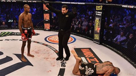 Cyborg Santos Suffers One Of The Most Gruesome Mma Injuries Ever Video