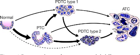 Figure 1 From A New Mouse Model Of Poorly Differentiated Thyroid