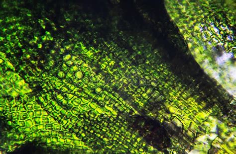 Moss Plant Under Microscope