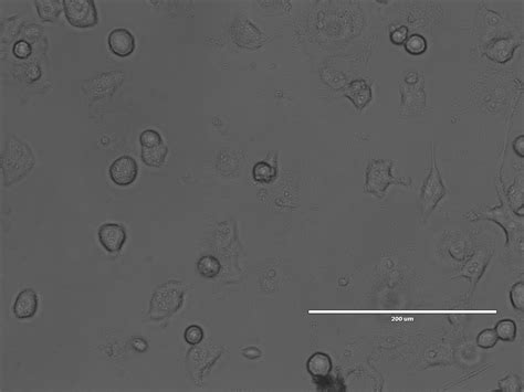 Are They Cell Debris Or Contamiantion Researchgate