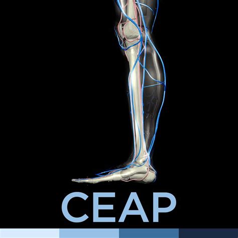 Venous Classification Workbook American Venous Forum