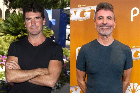 Simon Cowells Plastic Surgery Everything The Music Mogul Has Revealed