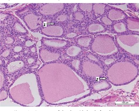 Figure 2 From Comparative Morphology Of The Thyroid Gland Semantic