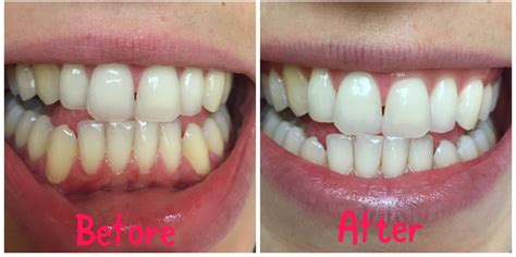 Smile Gallery Theodore Sewitch Dmd Ms New York