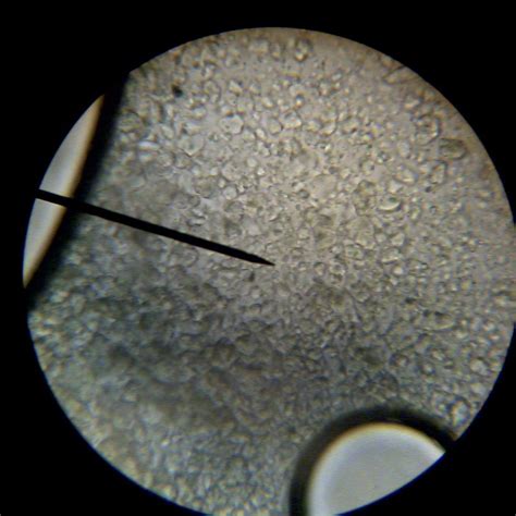 Toothpaste Under A Microscope At Barbara Slye Blog