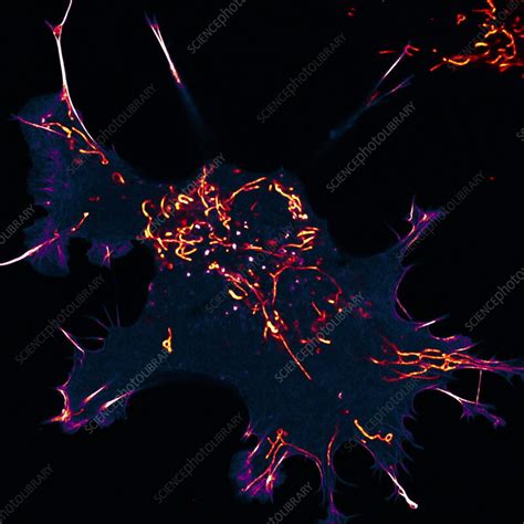 Ewing Sarcoma Cancer Cell Confocal Light Microscopy Stock Video Clip