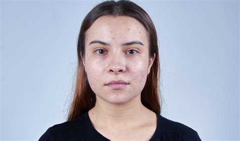 Why Is My Skin So Oily All Of A Sudden