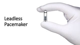 Micra Leadless Pacemaker Insertion Techniquepptx