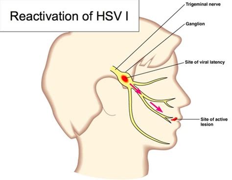 Week 8 Herpes Simplex Virus Flashcards Quizlet