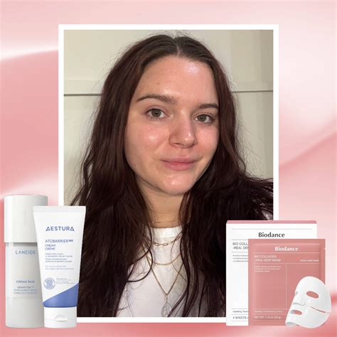 Prfm Undereye Injections Review And Beforeafter Photos Marie Claire