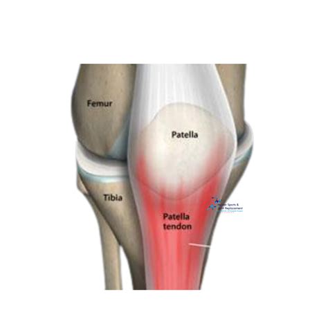 Knee Tendon And Bursa Pain Hip Knee Shoulder Surgeon Newcastle Dr