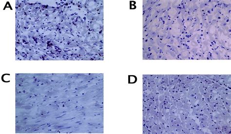 Induction Of Immunologic Tolerance To Cardiac Allograft By S Transplantation