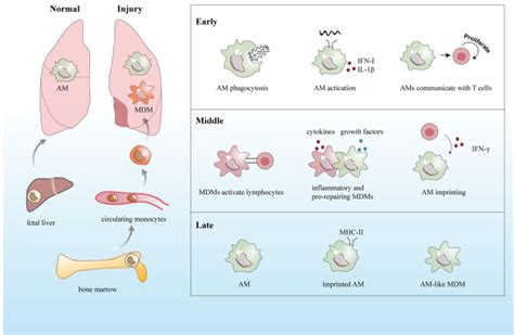 综述：靶向肺泡巨噬细胞：肺部感染和急性肺损伤的有希望干预策略 生物通