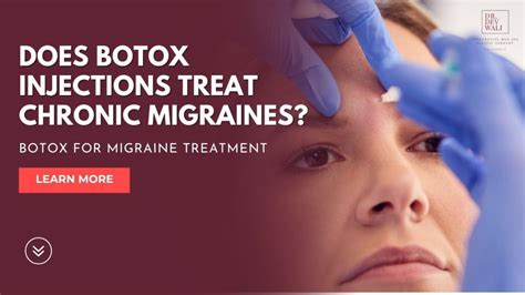 Botox Treatment For Migraine What To Expect Dr Dev Wali