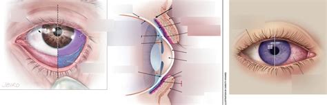 4c Conjunctiva Diagram Quizlet