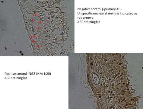 How Can I Eliminate High Background And Unspecific Nuclear Staining