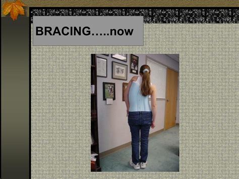 Ppt Common Spinal Deformities Powerpoint Presentation Free Download Id 1700393