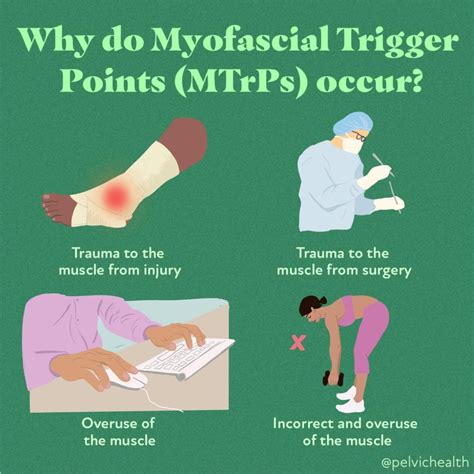 Manual Therapy For Myofascial Pain Part 1