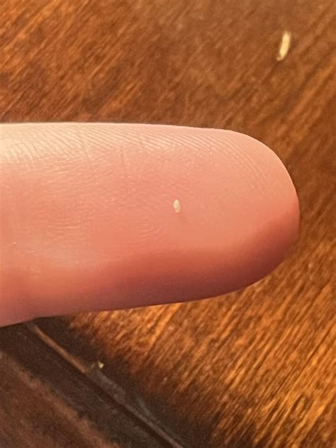 Is This An Egg Rlice