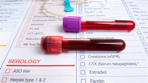 Serological Tests What They Are How They Work And What To Expect