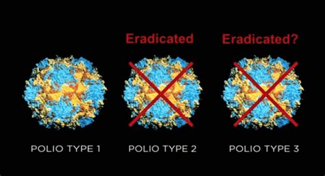 Polio Type 3 Eradicated Globally