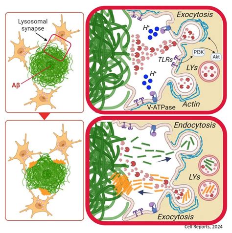 How Microglia Degrade Large Alzheimers Amyloid Beta Plaques Sciencemission