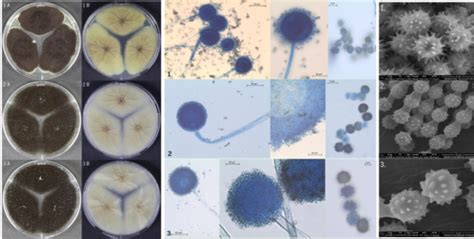 Phd Highlights Marta Simões Sociedade Portuguesa De Microbiologia