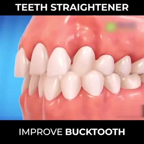 Azra Bashir On Linkedin Multifunctionalinvisiblesilicone Smileconfidently Smilecomfortably