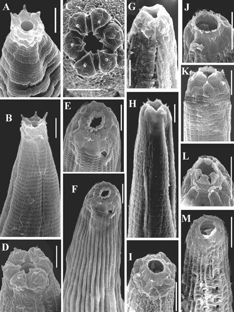 Scanning Electron Micrograph Of Anterior End Of Few Extracted