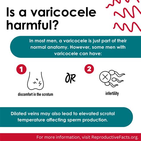 Varicocele