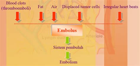 Knowledge Embolus