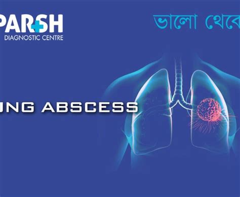 Pleural Infection Empyema Causes Symptoms Diagnosis And Treatment