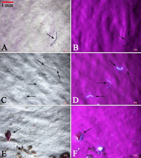 Microplastic Particles On Filters Observed With And Without A Uv