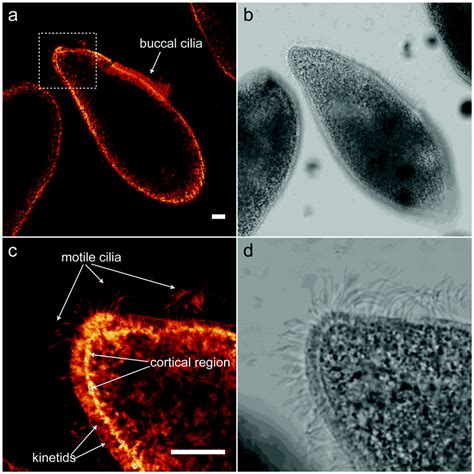 Blepharisma Under Microscope