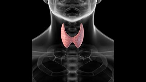 Medgrow Endocrinology And Dm Course Day 16 Hypothyroid And Myxedemic