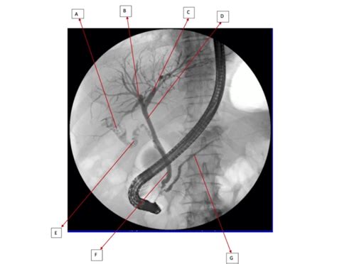 Fleuro Radiograph Ercp Quiz