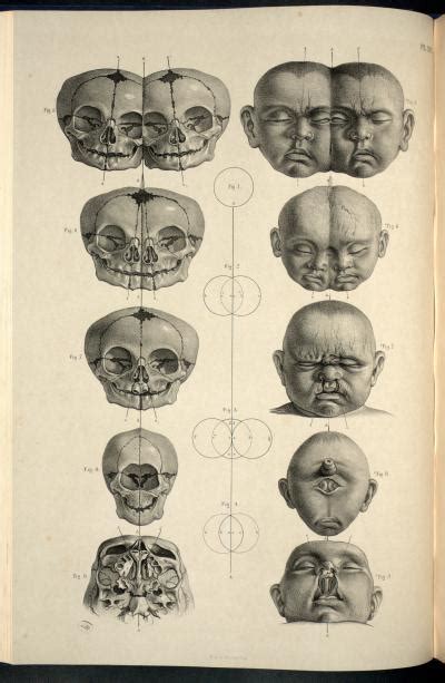 Morbid Anatomy Joseph Maclise 1815 1880