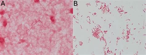 A Flagella Like Gram Negative Streptobacillus Moniliformisrods In
