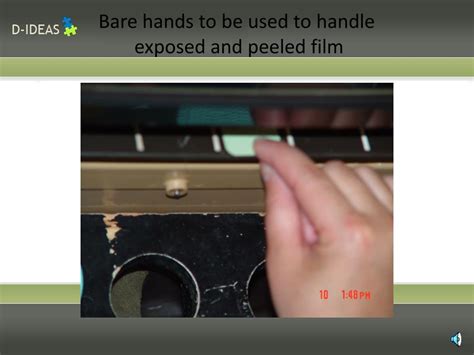 Ppt Infection Control In Dental Radiology Powerpoint Presentation