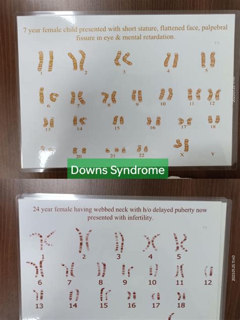 Genetics Staining Pdf