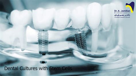 Growing Teeth By Using Stem Cells Dr Jamilian