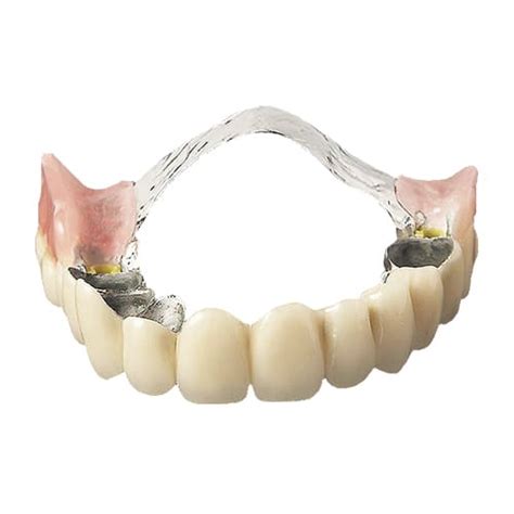Telescopic Denture Clinical Guide Medimatch Dental Laboratory