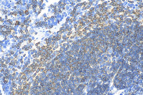 Cd79a Antibody 31887 1 Ap Proteintech
