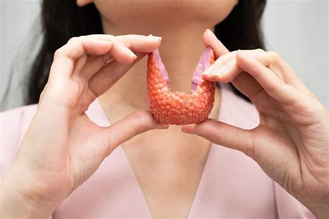 Hyperthyroidism Overactive Thyroid Thyroid Lymphoma Asian Woman With