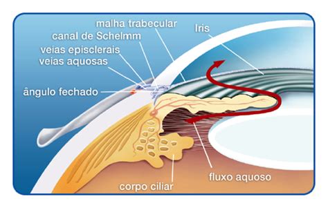 Glaucoma Oftalmocenter