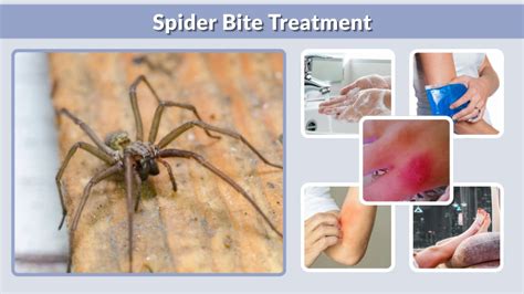 Spider Bite Symptoms And Treatment Complete Guide