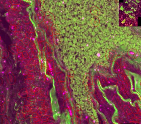 Positive Dye Cell Count In Qupath For Analysis Of Rna Scope Image