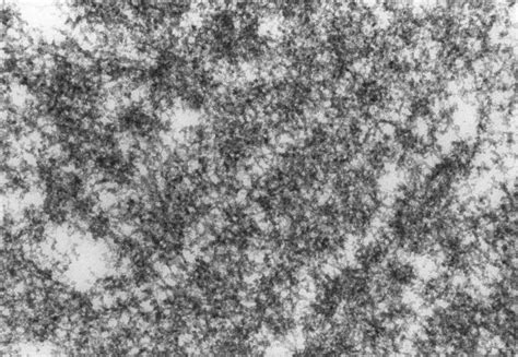 Drosophila Melanogaster Polytene Chromosome Cil25330 Doccheck